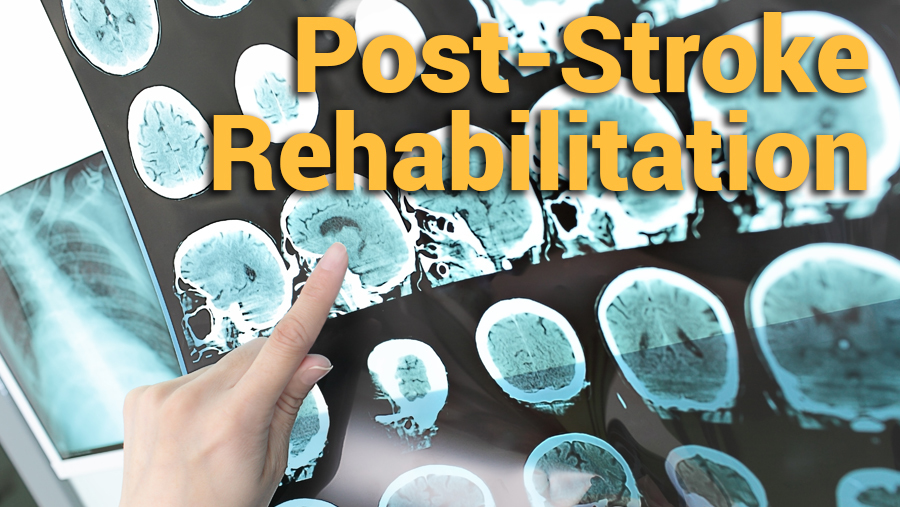 Post Stroke Rehabilitation Post Stroke Rehabilitation